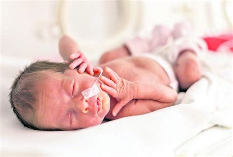 Bebes Prematuros De 28 Semanas Actualizado Noviembre 2024