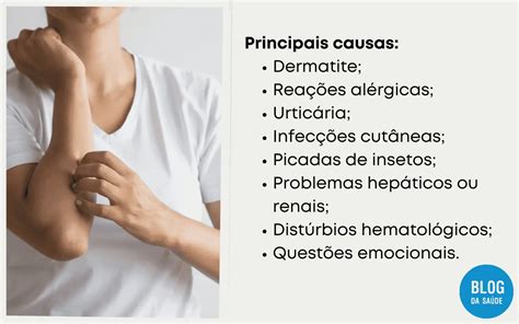 Coceira Pelo Corpo O Que Pode Ser Blog Da Saúde