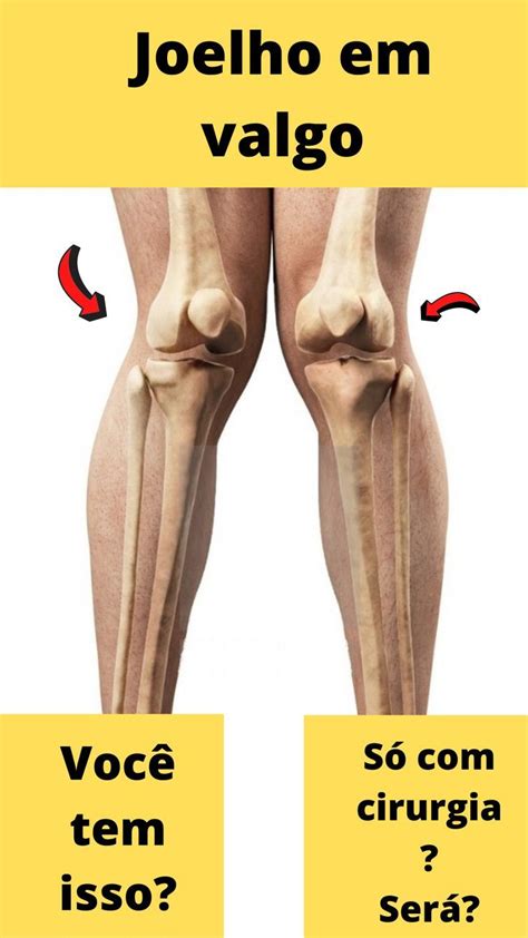 Você sabia que nem sempre a solução é cirurgia Na grande maioria dos