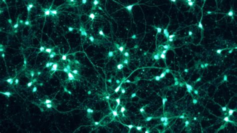 Structure Of A Neuron Owlcation