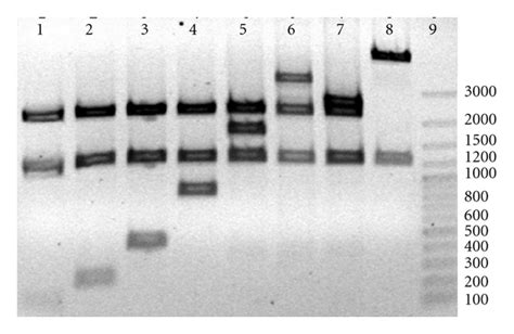 Agarose Gel Electrophoresis Of Bbsi Bsai Double Digested Plasmids