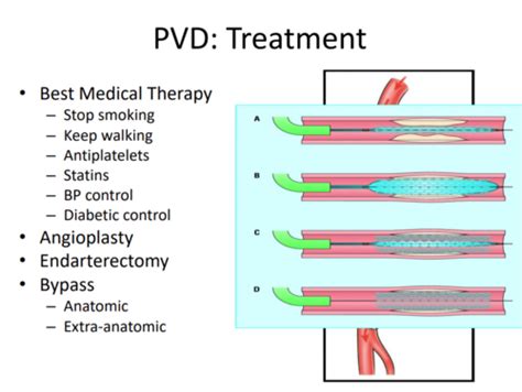 Peripheral Vascular Disease Flashcards Quizlet