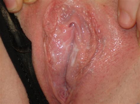 Dirty Smegma Pussy Mega Porn Pics