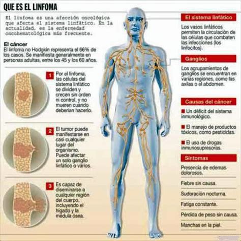 Sintomas De Cancer De Linfoma No Hodgkin CancerWalls