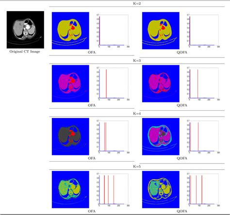 multilevel thresholding segmentation results obtained from ofa and ofa download scientific