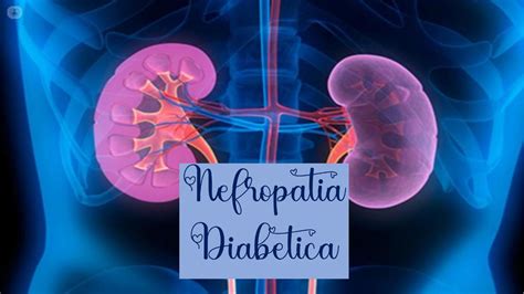 Nefropatía Diabética MakiDear uDocz