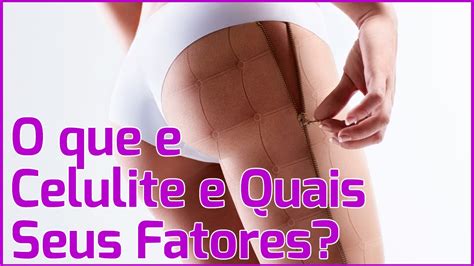O que é Celulite Quais os Principais Fatores 2015 HD YouTube
