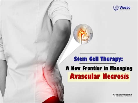 Stem Cell Therapy New Frontier In Managing Avascular Necrosis