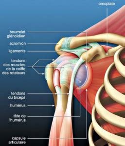 Tendinopathie De La Coiffe Des Rotateurs Clinique Du Sport