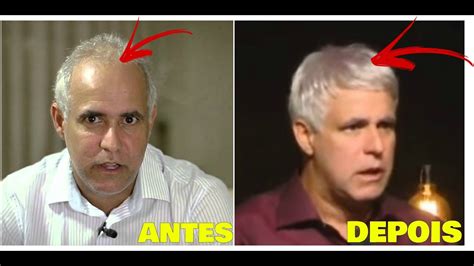 OQUE O PASTOR CLAUDIO DUARTE FEZ PRA CRESCER O CABELO TÃO RÁPIDO