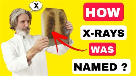 How X Rays Named Discovery Of X Rays Doctor Inside Academy Go IT