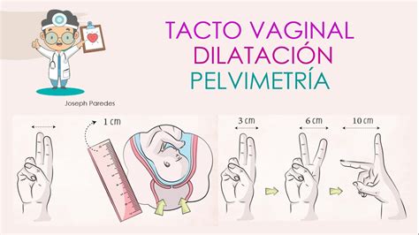 Tacto Vaginal Dilatación Pelvimetria Joseph Paredes YouTube