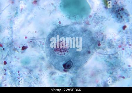 This Photomicrograph Of A Trichrome Stained Specimen Revealed A Mature