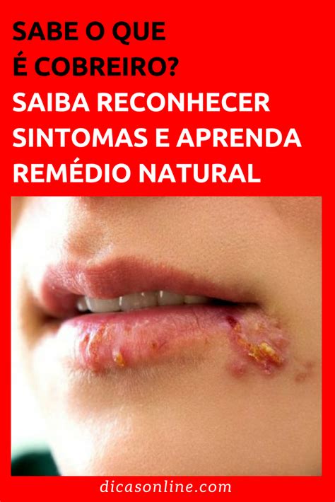 Como Tratar Cobreiro