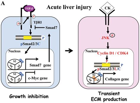 TGF β Smad signaling during hepatic fibro carcinogenesis Review