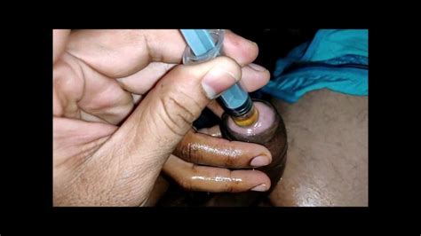 Wife Milks Husbands Sperm With E Stim And A Vacuum Pump Estim Homemade