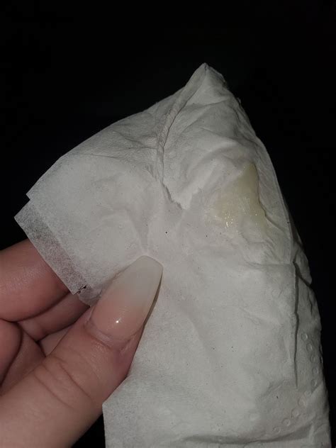 Mucus Plug Babycenter