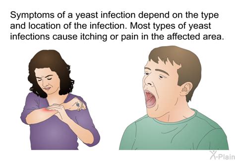 PatEdu Yeast Infections