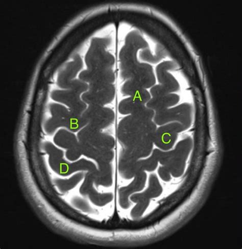 Image Radiopaedia Org