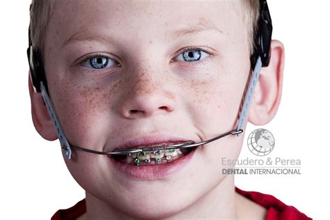 Preguntas y respuestas Odontopediatría A que edad le debo poner a mi