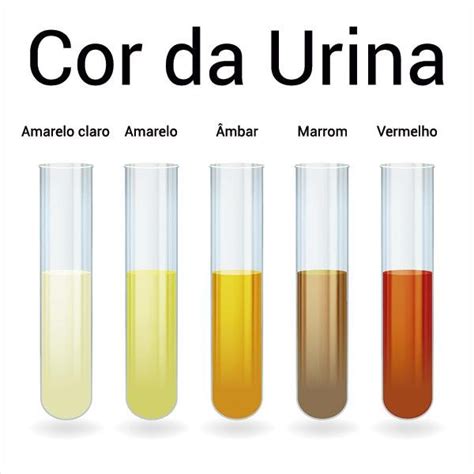 O que a cor da sua urina quer dizer sobre sua saúde