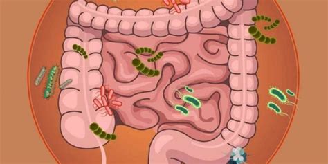 ℹ Sobrecrecimiento Bacteriano del Intestino Delgado SIBO Tu mejor guía