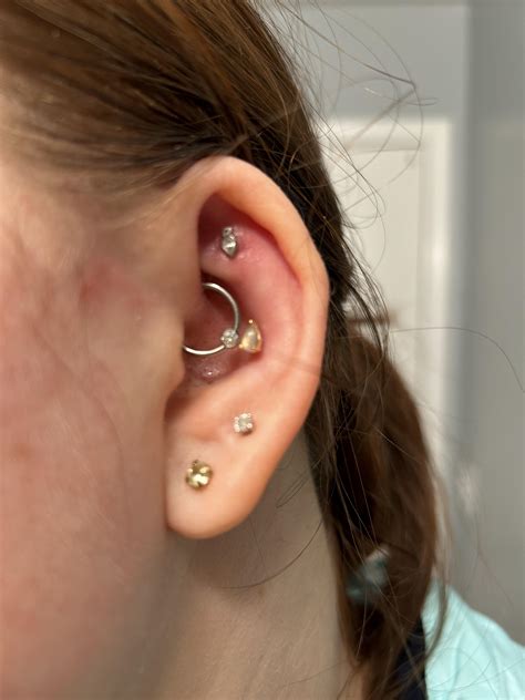 Small Granuloma R Piercing
