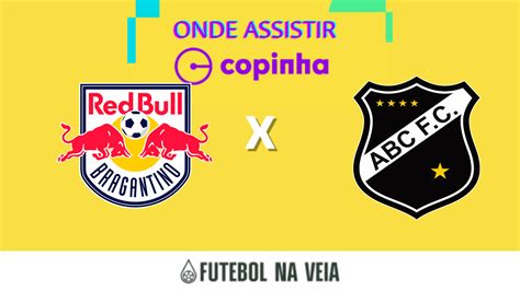 RB Bragantino x ABC Ao Vivo E Online Onde Assistir Horário E