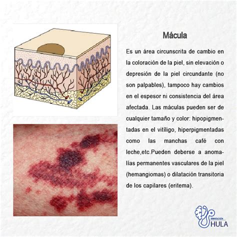 Semiologia de Piel y Anexos Gastro Mérida