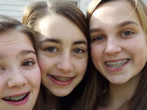 Cute Girls With Braces Braces Girls Cute Braces Braces And Glasses Punky Brewster