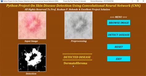 skin disease detection using convolutional deep learning neural network python source code