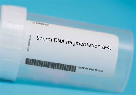 Sperm DNA Fragmentation Test In Indore AIIM