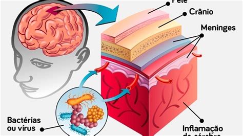 O Que Meningite Causas E Como Se Proteger Kayo Tv Youtube