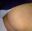 Analyope Un Homme Ans Villeurbanne Lope Vide Couilles