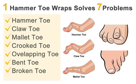 Welnove 6Pcs Hammer Toe Straightener Hammer Toe Splints Toe Cushioned