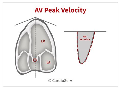 Aortic Stenosis Breaking Down The Continuity Equation Cardioserv