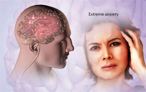 Health Condition Symptoms Causes Treatment And More