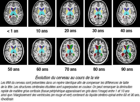 Evolution Du Cerveau Humain