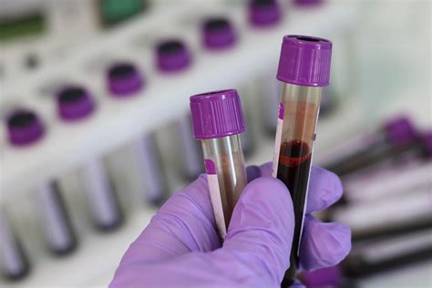 Hepatitis B cómo se contagia y cómo prevenirla Canal 9 Televida Mendoza