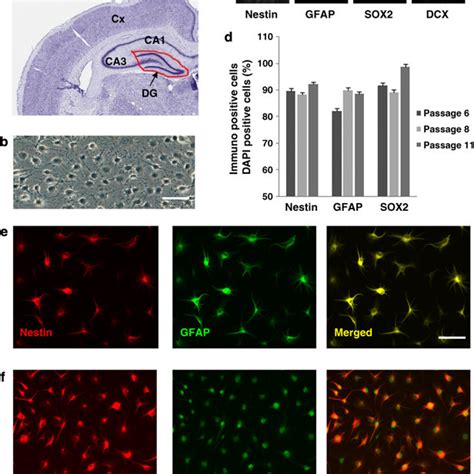 Isolation And Characterization Of Adult Rat Dentate Gyrus Derived