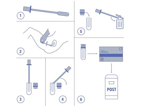Pap Smear Procedure Steps
