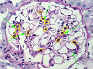 Mesangial Cell Histology