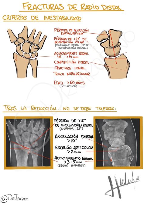 10 Tipos De Fracturas Rela