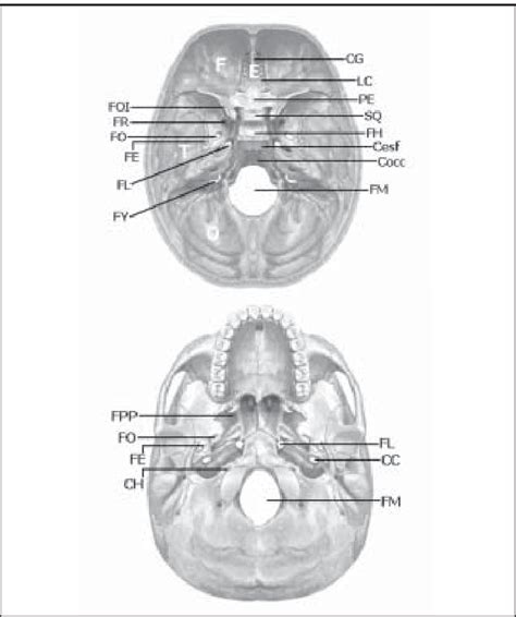 a b Anatomía normal base de cráneo vista superior a e inferior b