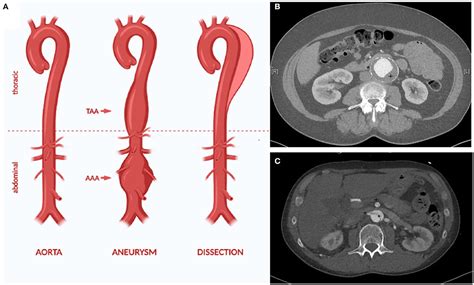 Frontiers Inflammasome Targeted Therapy As Novel Treatment Option For