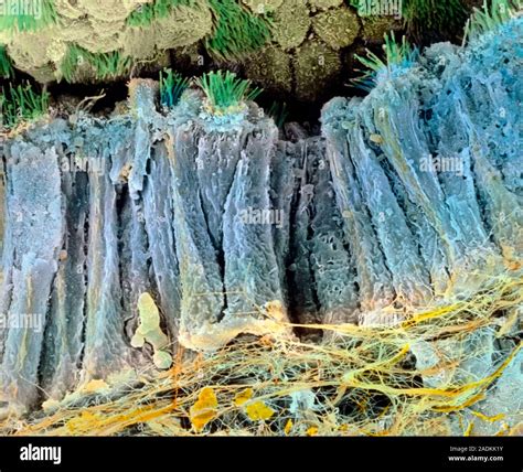 Fallopian Tube Coloured Scanning Electron Micro Graph SEM Of