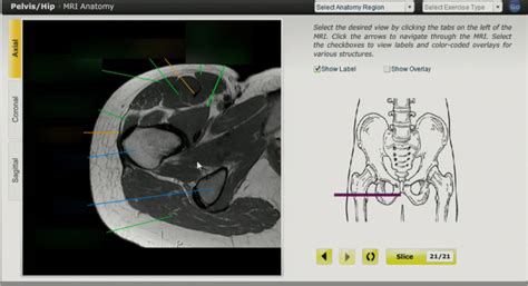 Hip Mri Axial Slice Diagram Quizlet