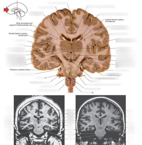Brain Slice Diagram Quizlet