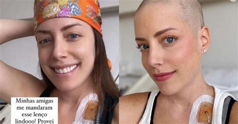 Koka Influenciadora Fabiana Justus Raspa O Cabelo Durante Tratamento