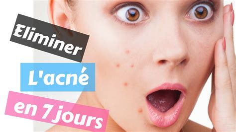 Traitement Acné DÉCOUVREZ LA SOLUTION EFFICACE YouTube